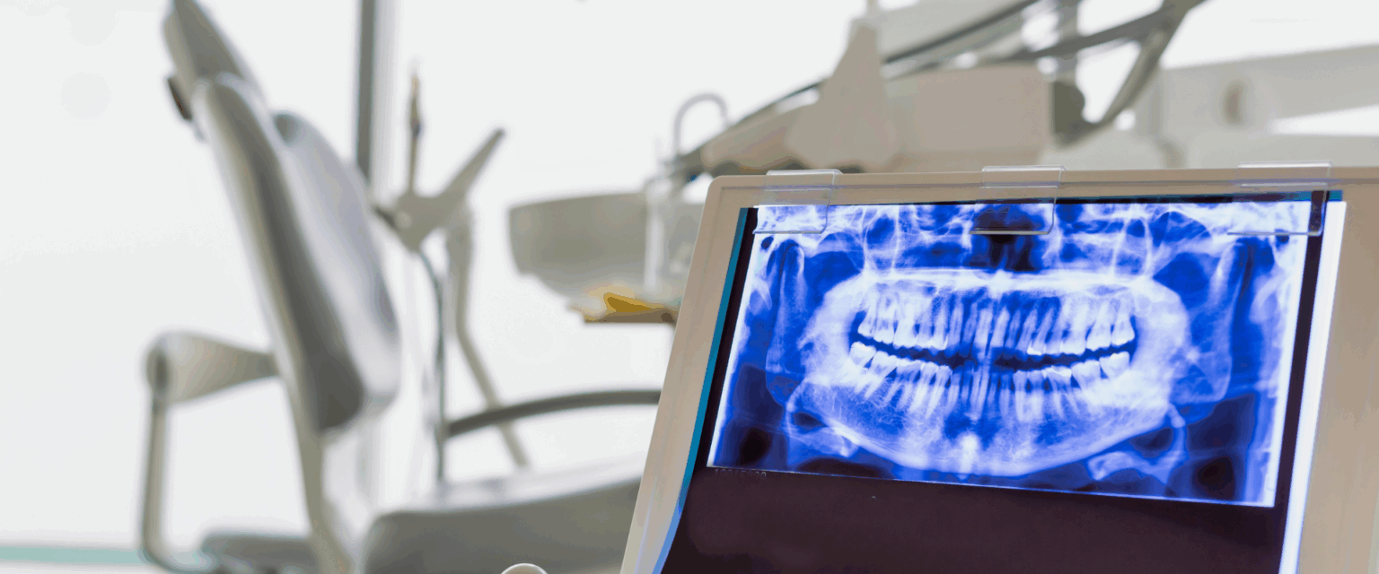 TMJ Billing: ICD-10 Diagnosis Codes and Documentation | eAssist
